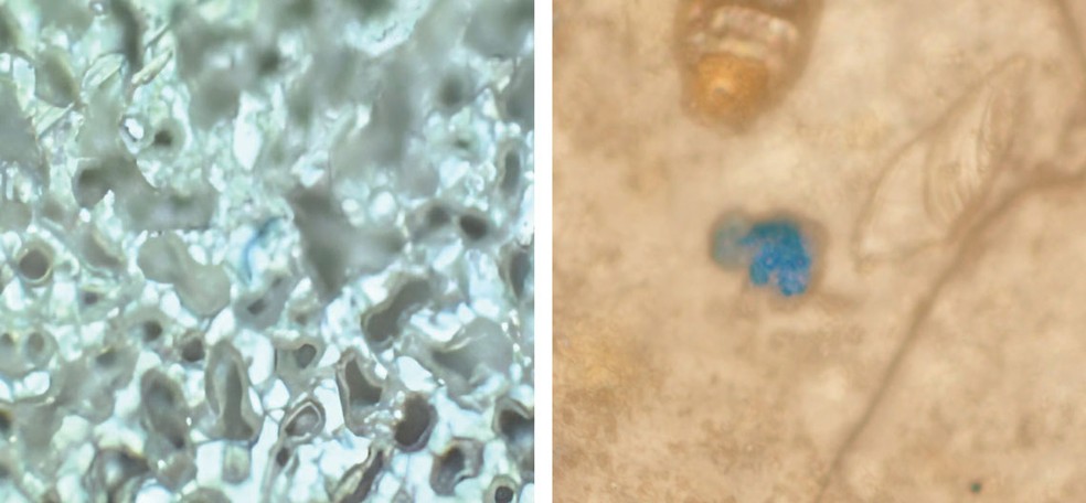 Equipe da USP identifica microplásticos no cérebro humano